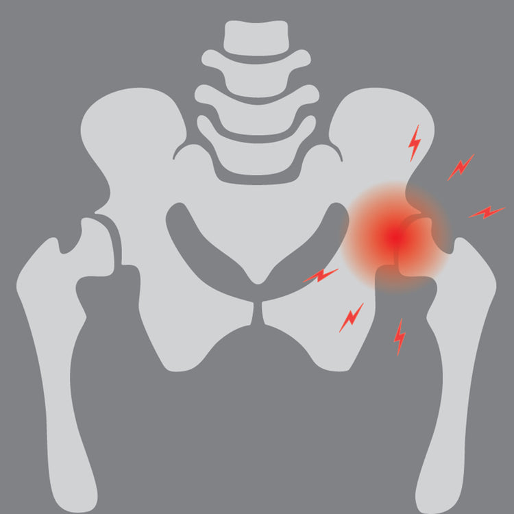 Stoko | Women's Supportive Short | The Best Hip & Back Support